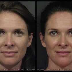 REBECCA FITZGERALD MD - 34 Photos & 162 Reviews - 321 N Larchmont Blvd ...