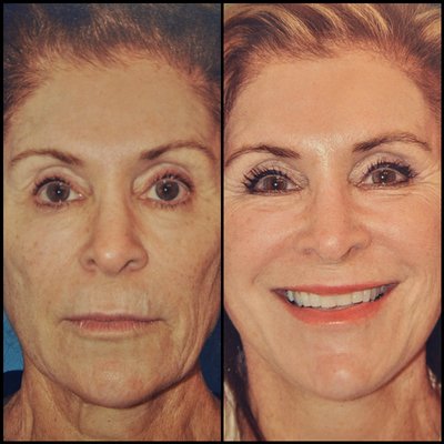 BARRY M. WEINTRAUB MD - Updated October 2025 - 64 Photos & 101 Reviews ...