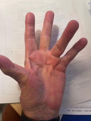 KEITH DENKLER, MD - Updated January 2026 - 14 Photos & 73 Reviews - 275 ...