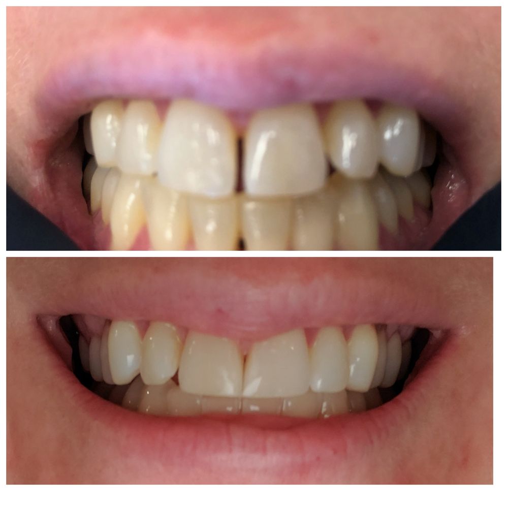 MARK W JACOB, DDS - Updated July 2024 - 10 Photos & 30 Reviews - 707 ...