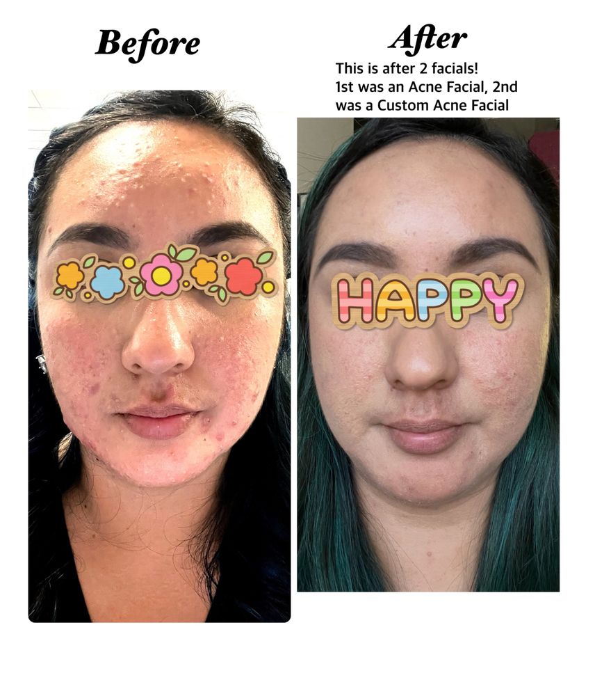 TSELANI SKIN CARE - Updated September 2025 - 23 Photos & 55 Reviews ...