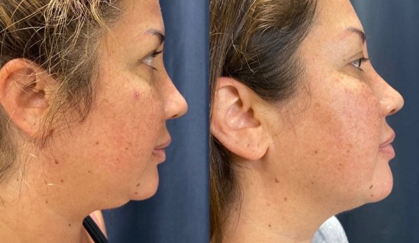 ALOHA LASER AESTHETICS - Updated February 2025 - 27 Photos & 38 Reviews ...