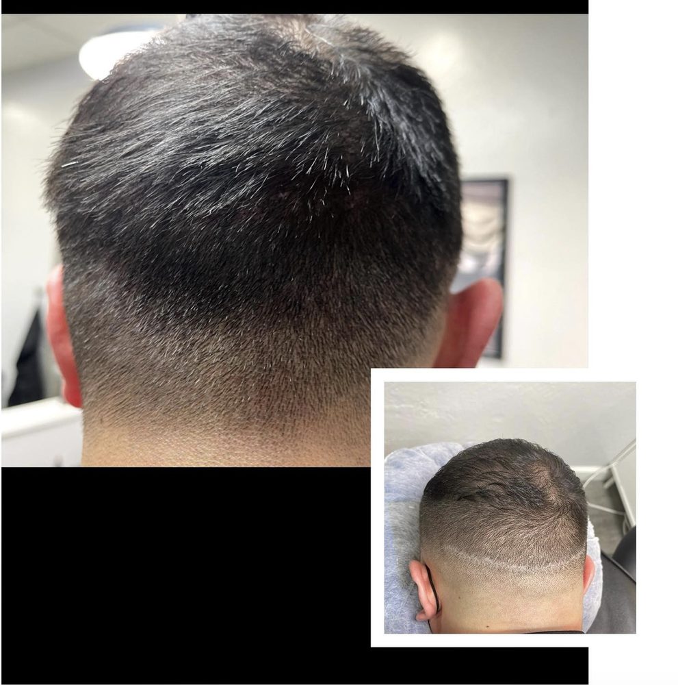 SCALP INK | 25 Photos - 717 K St, Sacramento, California - Hair Loss ...