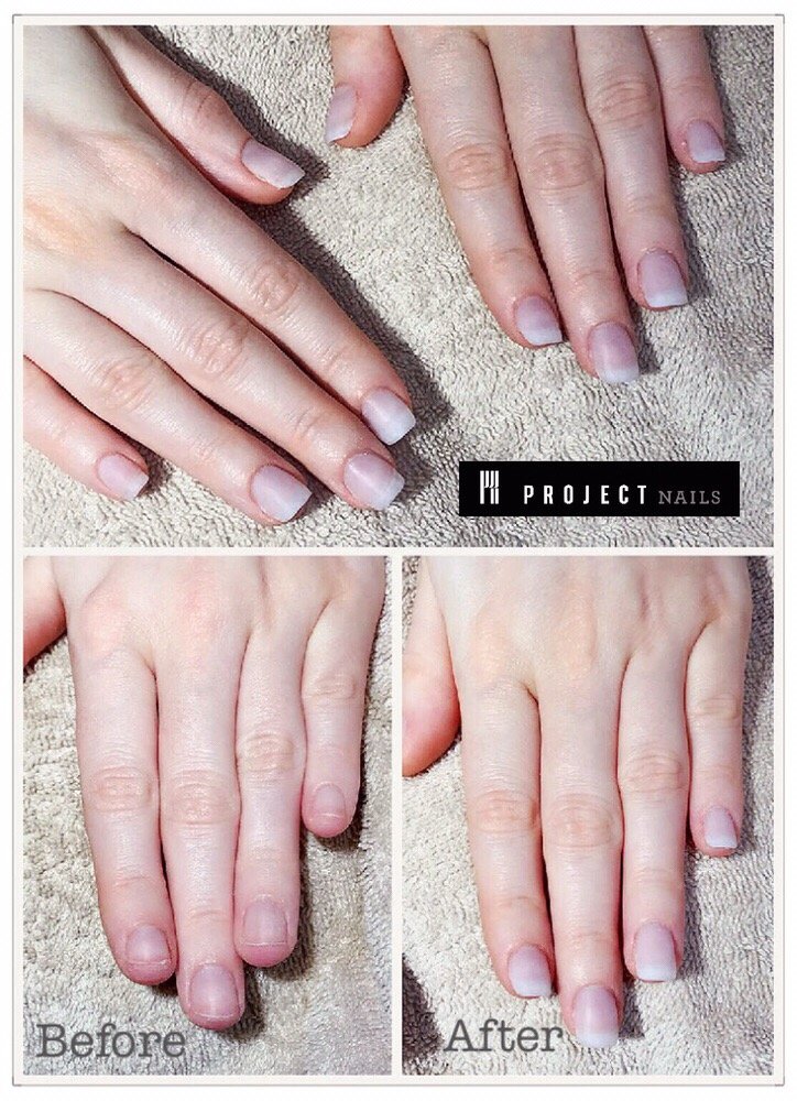 PROJECT NAILS - Updated September 2024 - 167 Photos - 83 East Coast Rd ...