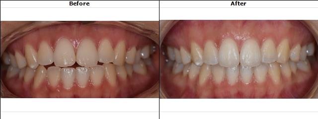 ADG DENTAL - 12 Photos - 1555 W Broadway, Vancouver, British Columbia ...