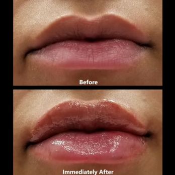 VELVET EFFECT LASERS - Updated May 2025 - 145 Photos & 101 Reviews - 62 ...