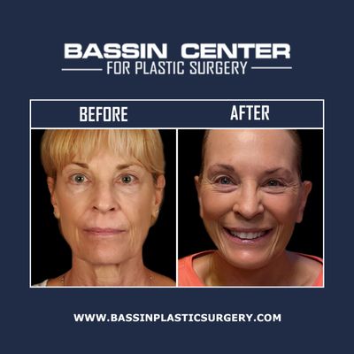 THE BASSIN CENTER FOR PLASTIC SURGERY - Updated July 2025 - 29 Photos ...