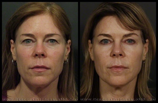 REBECCA FITZGERALD, MD - Updated December 2025 - 34 Photos & 188 ...