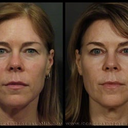 REBECCA FITZGERALD MD - 34 Photos & 163 Reviews - 321 N Larchmont Blvd ...