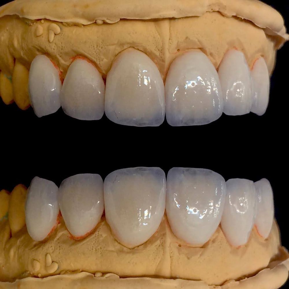 CALIFORNIA SMILE CAD - Updated October 2025 - 3535 Ross Ave, San Jose ...