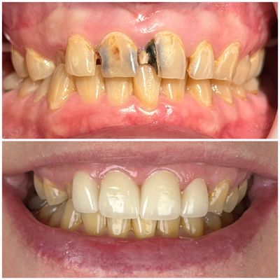 SUPREME DENTAL - Updated October 2025 - 160 Photos & 299 Reviews - 6255 ...