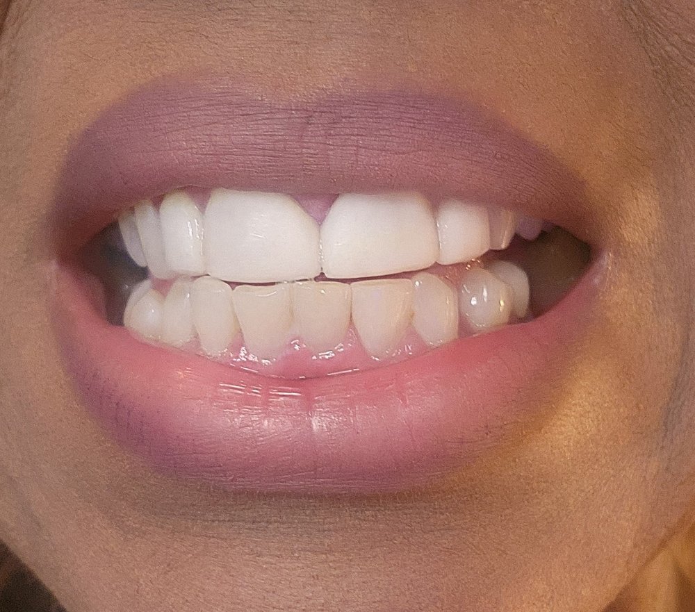 LAUREL SMILES DENTAL CARE - Updated September 2025 - 14440 Cherry Lane ...