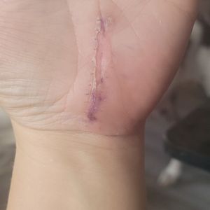 ANDREW BRONSTEIN, MD - Updated December 2025 - 89 Reviews - 10135 W ...