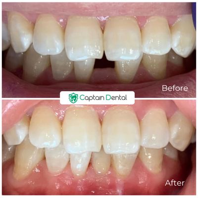 CAPTAIN DENTAL - Updated December 2025 - 34 Photos & 23 Reviews - 1690 ...