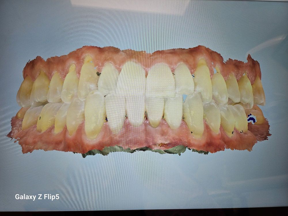 STEVE TASSONE, DDS - Updated December 2025 - 31 Photos & 95 Reviews ...