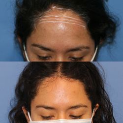 EVAN RANSOM, MD - 123 Photos & 171 Reviews - Cosmetic Surgeons - 450 ...