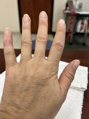 HAND CENTER OF NEVADA - Updated December 2025 - 29 Photos & 85 Reviews ...