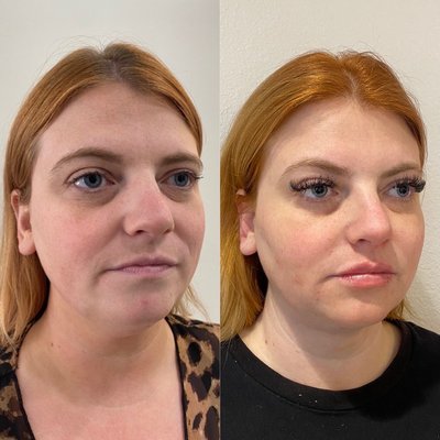 The Beauty Co.Lab - Trusted Since 2022 - Updated July 2025 - 12 Photos ...