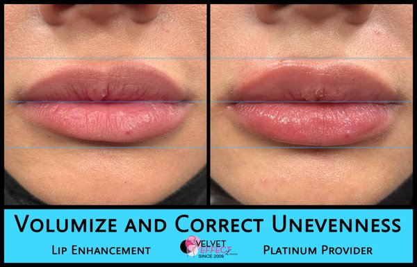 VELVET EFFECT LASERS - Updated January 2025 - 144 Photos & 101 Reviews ...