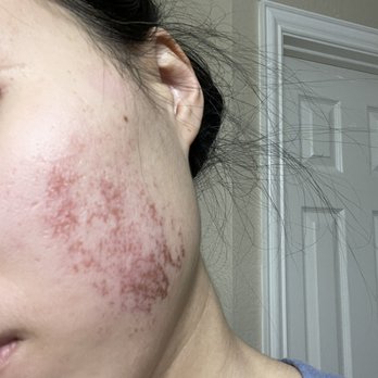 MERUM FACE BAR - Updated May 2025 - 11 Photos & 14 Reviews - 962 ...