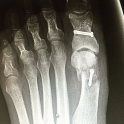 BEN TEHRANI, DPM - KINGS POINT FOOT & ANKLE - 16 Photos & 22 Reviews ...