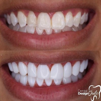DENTAL DESIGN SMILE - Updated April 2025 - 41 Photos & 51 Reviews ...