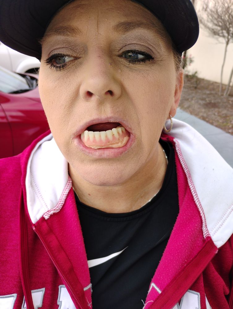 AFFORDABLE DENTURES & IMPLANTS - Updated December 2025 - 4439 Rangeline ...