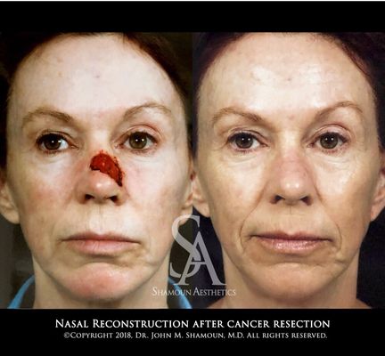 JOHN M. SHAMOUN, MD FACS - Updated March 2026 - 316 Photos & 127 ...
