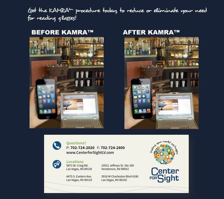 CENTER FOR SIGHT - Updated January 2026 - 30 Photos & 93 Reviews - 330 ...