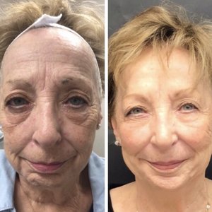 VICKI RABIN, MD - Updated October 2025 - 2300 Green Oak Dr, Kingwood ...