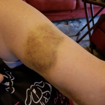 RECOVERY INNOVATIONS - Updated December 2025 - 48 Reviews - 11361 N ...