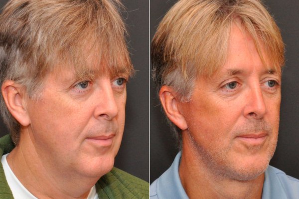 ALEXANDER S DONATH, MD - Updated September 2025 - 31 Photos & 11 ...