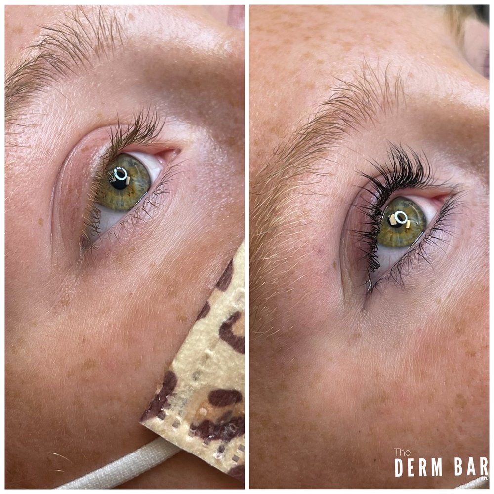 THE DERM BAR STL - 13 Photos - 10401 Olive Blvd, Creve Coeur, Missouri ...