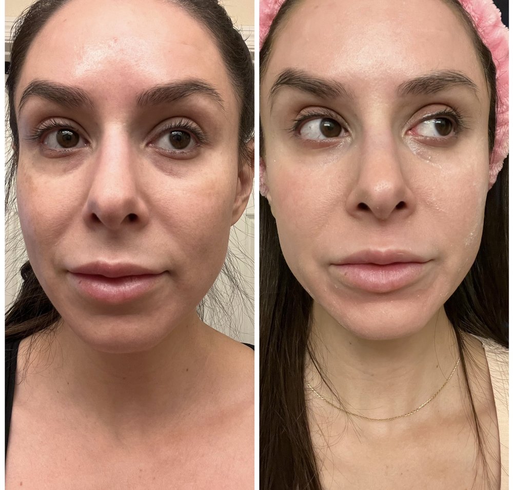 SAMEER BASHEY, MD FAAD - Updated October 2025 - 49 Photos - 9025 ...