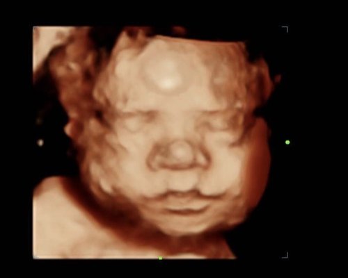 STORK VISION 3D/4D ULTRASOUND GRAPEVINE - 27 Photos & 26 Reviews - 520 ...