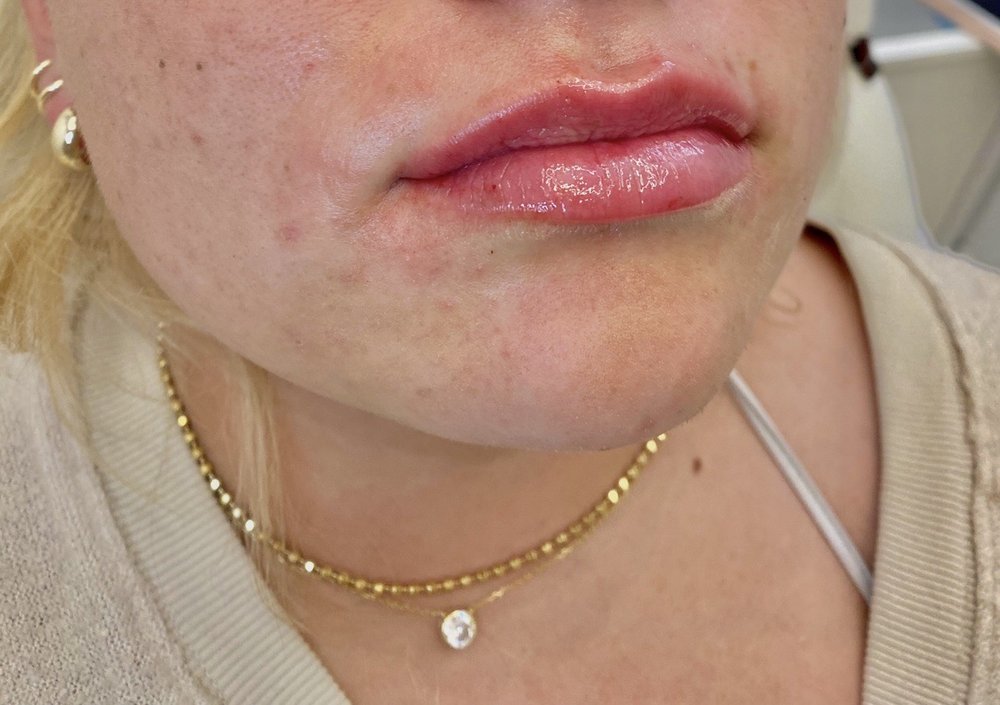 LEXRX - BOSTON - Updated April 2025 - 12 Photos & 28 Reviews - 121 ...