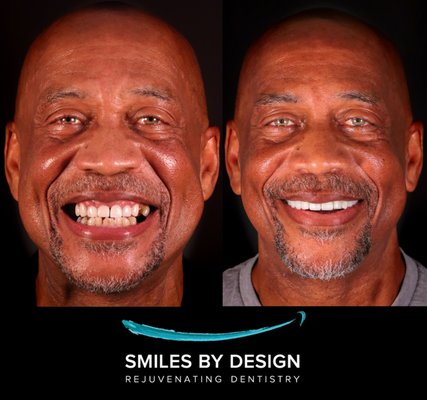 SMILES BY DESIGN - REJUVENATING IMPLANT DENTISTRY - Updated December ...