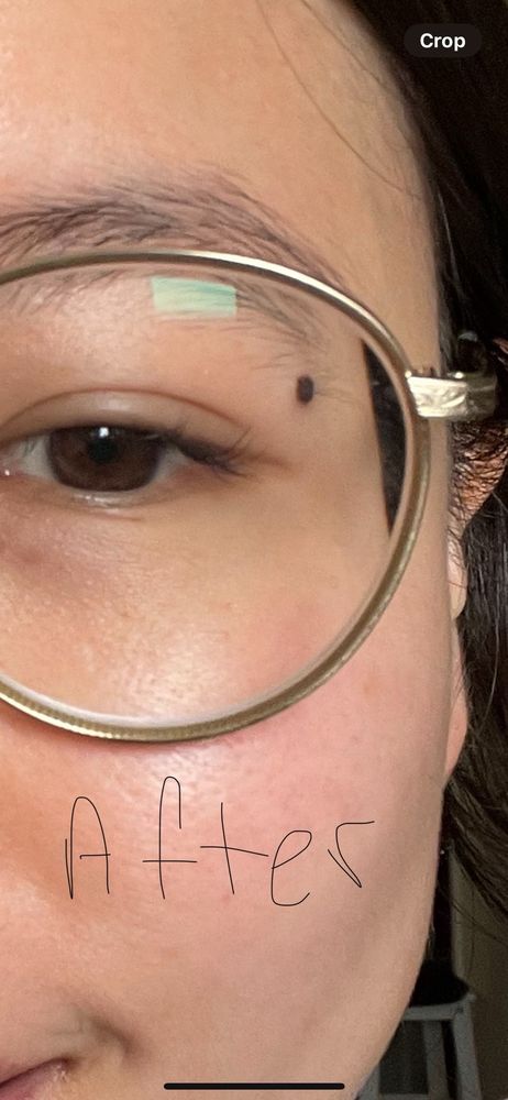 CHELSEA SKIN AND LASER - Updated January 2026 - 80 Photos & 137 Reviews ...