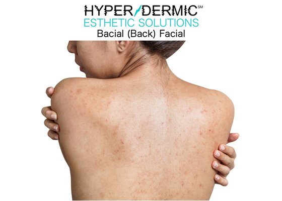 HYPERDERMIC ESTHETIC SOLUTIONS - Updated April 2024 - 3841 Evergreen ...