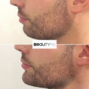 BEAUTYFIX MEDSPA - Updated November 2024 - 94 Photos & 255 Reviews - 18 W 23rd St, New York, New ...