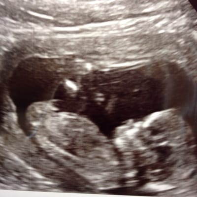 GREGORY ROSEN, MD - Updated October 2025 - 24 Reviews - 6330 San ...