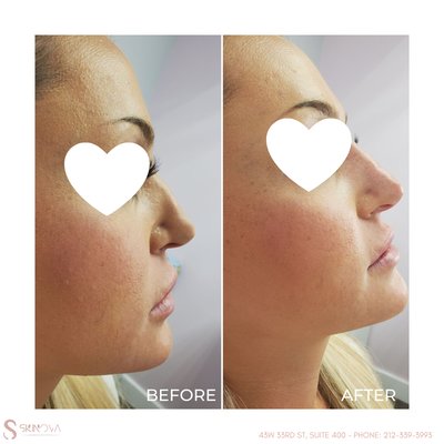 SKINOVA MEDSPA - Updated January 2025 - 68 Photos & 103 Reviews - 43 ...