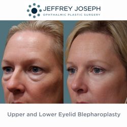 JEFFREY JOSEPH, MD - 36 Photos & 63 Reviews - Cosmetic Surgeons - 5010 ...