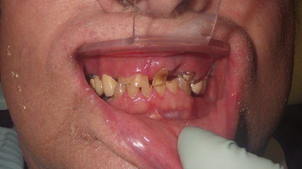 DAVID W HYTEN, DMD - Updated October 2025 - 22 Photos - 2110 Troy Rd A ...