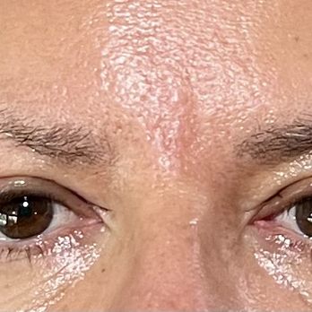 JEFFREY JOSEPH, MD - Updated May 2025 - 44 Photos & 94 Reviews - 5010 ...