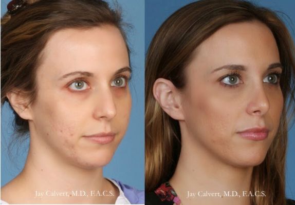 DR JAY CALVERT PLASTIC SURGERY - Updated December 2025 - 39 Photos & 34 ...