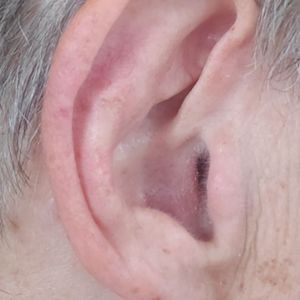 MELYSSA HANCOCK, MD - Updated November 2024 - 1601 Clint Moore Rd, Boca ...