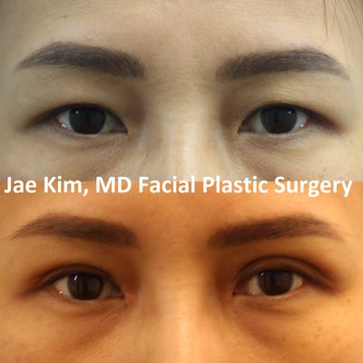JAE KIM MD, FACIAL PLASTIC SURGERY - Updated January 2026 - 21 Photos ...