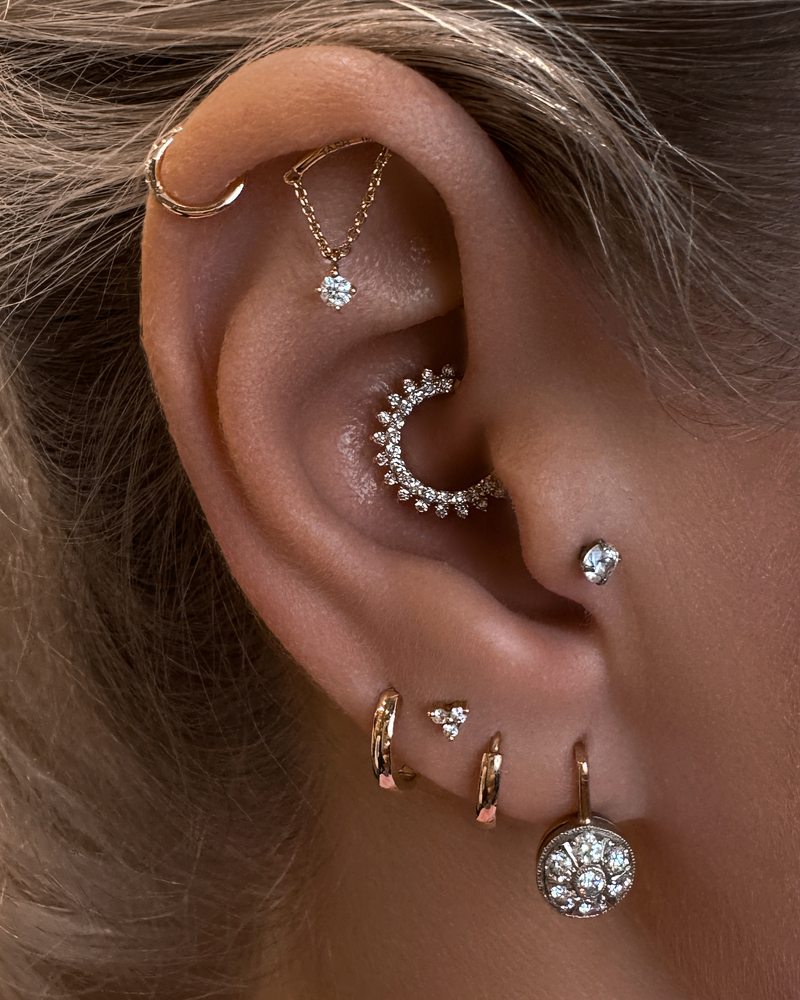 MAGIC NEEDLES - Updated May 2024 - Request an Appointment - 935 Kings ...