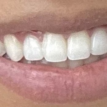 STEVE TASSONE, DDS - Updated March 2025 - 31 Photos & 80 Reviews ...